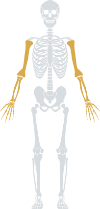 Complex Regional Pain Syndrome Treatment | Reflex Sympathetic Dystrophy